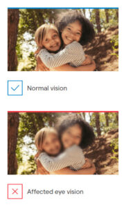 Cortical Cataracts: Causes, Symptoms & Vision Buddy’s Assistive Technology
